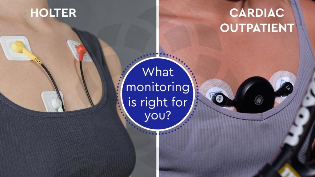 Holter Monitoring vs. Cardiac Outpatient Monitoring: Which is Right for ...